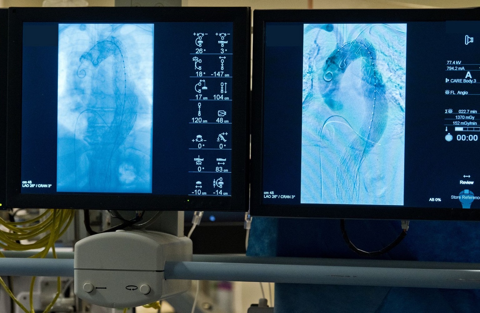 Valley Hospital offers patients minimally invasive technique for aortic ...
